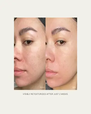 WESTMAN ATELIER Rollerball Skin Activator