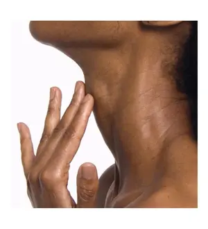 DERMELECT Self-esteem Professional Neck Firming Lift - Open Miscellaneous