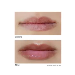 DERMELECT Smooth Lip Volumizer - Open Miscellaneous