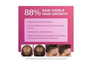 BOSLEYMD Hair Re-growth Foam 5% Minoxidil