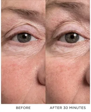 NOBLE PANACEA The Exceptional Eye Lift Concentrate - No Color