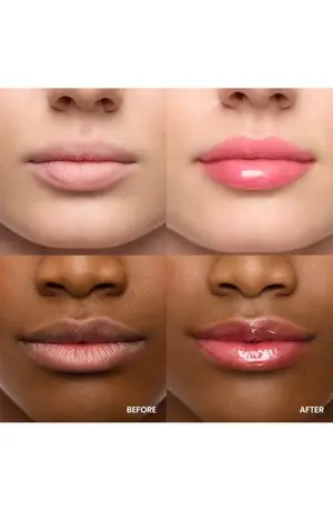 WONDERSKIN Lip Rehab Serum-in-oil - Amour