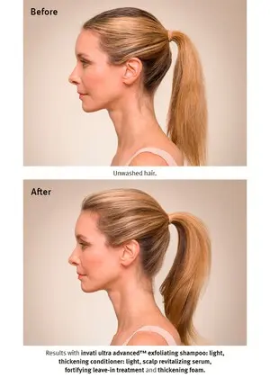 Aveda Invati Ultra Advanced System