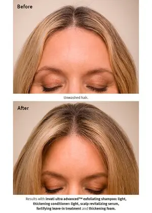 Aveda Invati Ultra Advanced System
