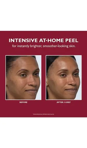 PETER THOMAS ROTH Even Smoother Instant Reveal Facial Peel - N,a