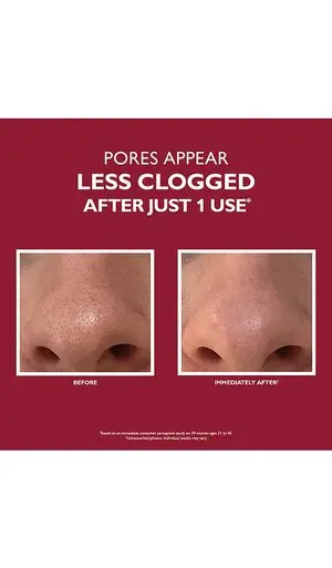 PETER THOMAS ROTH Even Smoother Microdermabrasion Exfoliating Pore Treatment - N,a