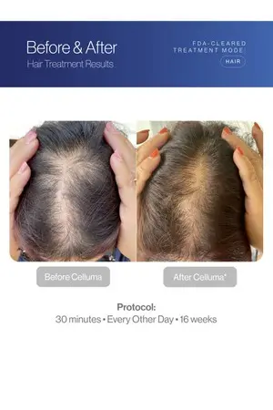 CELLUMA Restore Hair System