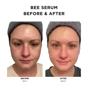 INTOXICATED COSMETICS Bee Serum + Hat Bundle | 1 Fl Oz/ 30 Ml | Anti-aging Formula With Vegan Snake Peptides | Hydrating Hyaluronic Acid
