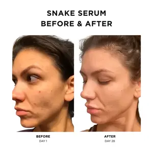 INTOXICATED COSMETICS Snake Serum | 1 Fl Oz/ 30 Ml | Anti-aging Formula With Vegan Snake Peptides | Hydrating Hyaluronic Acid | Niacinamide For