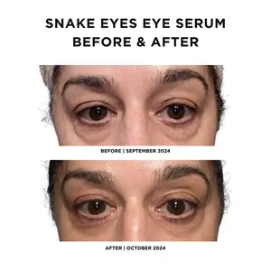 INTOXICATED COSMETICS Snake Eyes | Eye Serum | 0.68 Fl.oz/20ml Lifting Formula For Daily Moisture And Eye Contour