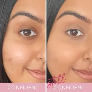DOLL 10 Doll Skin Anti-stress Skin Perfecting Concealer - Medium