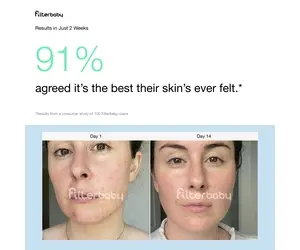 FILTERBABY Skincare Filter 2.0 - Chrome