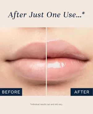 CITY BEAUTY Plumping Lip Gloss - Los Angelips