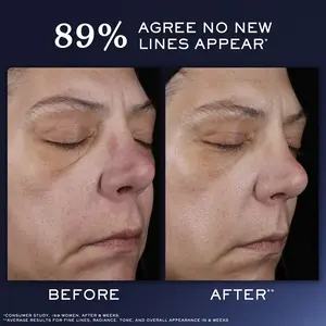 LANCOME Génifique Ultimate Recovery Serum - One-color