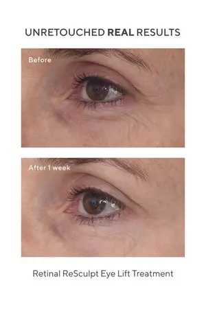 MURAD Retinal Resculpt Eye Lift Treatment - None