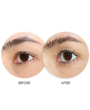 DERMELECT Xl Lash Volumizer
