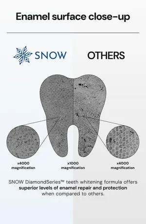 SNOW Diamondseries™ Dissolving Teeth Ning Strips