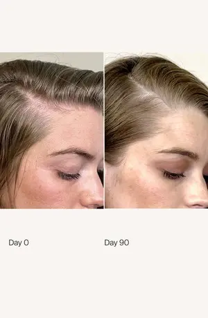 LIVING PROOF® Scalp Care Density Serum