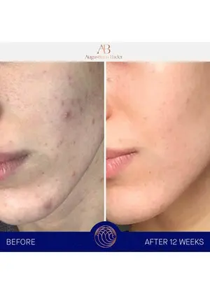 Augustinus Bader The Moisturisers Lightweight, Hydrating And Illuminating