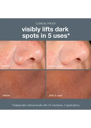 DERMALOGICA Powerbright Spot Peel