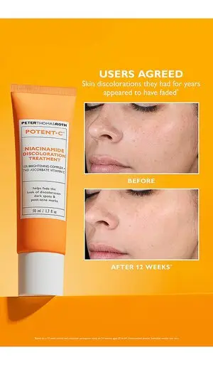 PETER THOMAS ROTH Potent-c Niacinamide Discoloration Treatment - N,a