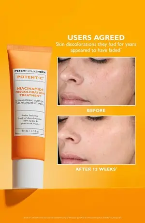 PETER THOMAS ROTH Potent-c Niacinamide Discoloration Treatment - No Color