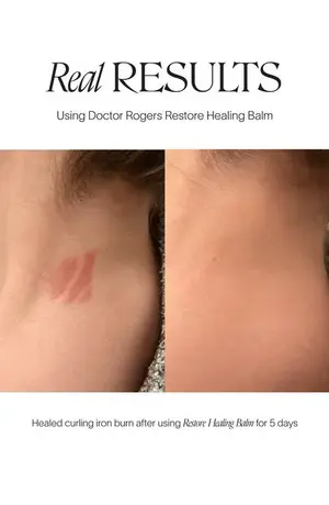 DOCTOR ROGERS RESTORE Restore Healing Balm