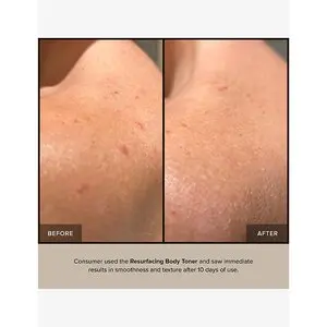 NUDESTIX Resurfacing Body Toner 150ml