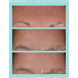 KATE SOMERVILLE Hydrakate™ Recharging Water Cream