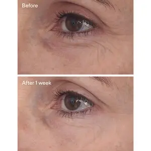 MURAD Retinal Resculpt Eye Treatment - One-color