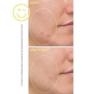 KATE SOMERVILLE Mega C-vit 30% Vitamin C Brightening Facial