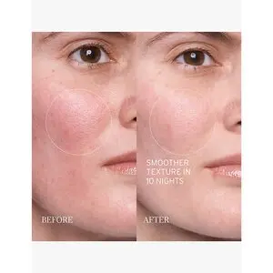 Fresh Lotus Youth Preserve Resurfacing Dream Serum