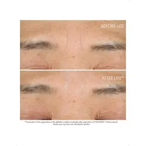 Dior Capture Totale Hyalushot - One-color