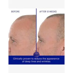 Augustinus Bader The Retinol Serum - One-color