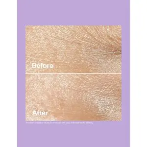 CLINIQUE Smart™ Clinical Repair Wrinkle Correcting Cream 75ml - One-color