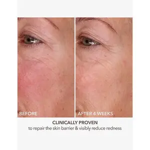 DR. DENNIS GROSS SKINCARE Derminfusions™ Fill + Repair Serum 30ml