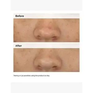 THE ORDINARY Balancing And Clarifying Serum - One-color