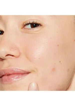 DERMALOGICA Liquid Patch Acne Treatments, Breakout Help