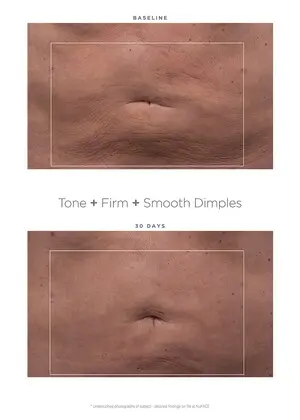 NUFACE Nubody Skin Toning Device