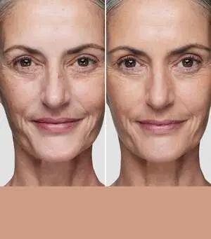 Laura Mercier Real Flawless Foundation - Metallic