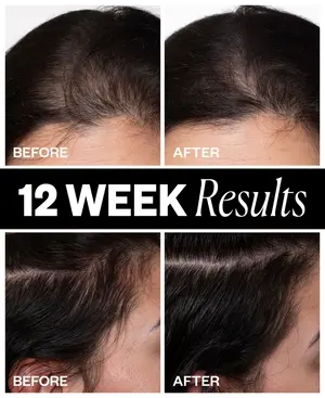 IGK Sponsored Hair Density Scalp Treatment - No Color