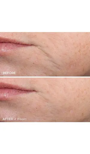 BEAUTYBIO The Zenbubble Gel Cream
