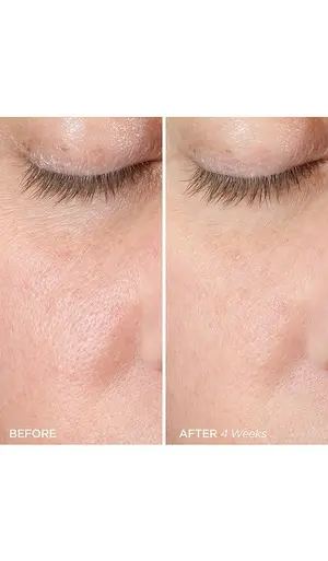 BEAUTYBIO The Zenbubble Gel Cream