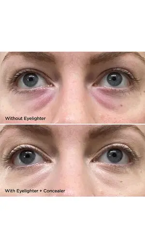 BEAUTYBIO The Eyelighter Concentrate - N,a