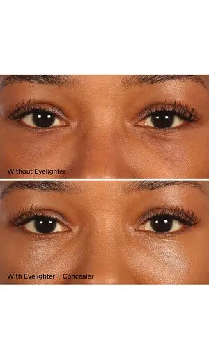 BEAUTYBIO The Eyelighter Concentrate - N,a