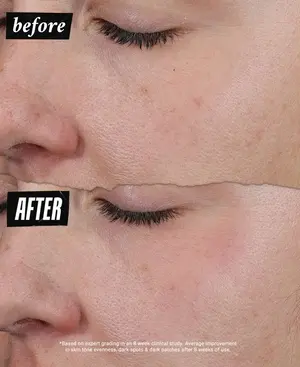 KIEHL'S SINCE 1851 Auto-tone Discoloration & Uv Solution - Us,ca