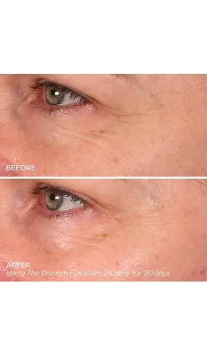 BEAUTYBIO The Quench Eye Balm