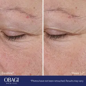 OBAGI MEDICAL Elastiderm Advanced Filler Concentrate