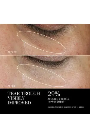 Estée Lauder Re-nutriv Ultimate Diamond Age Reversal Eye Cream
