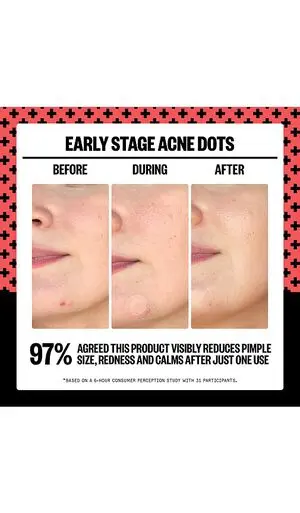 PEACE OUT 2% Salicylic Acid Early Stage Acne Dot 8 Dots - N,a